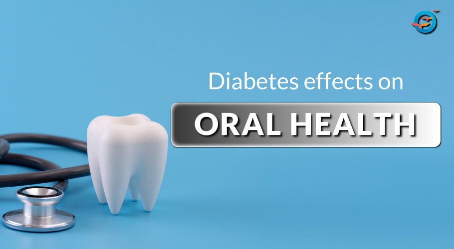 Diabetes And Dental Care | Best Dental Clinic - 130+